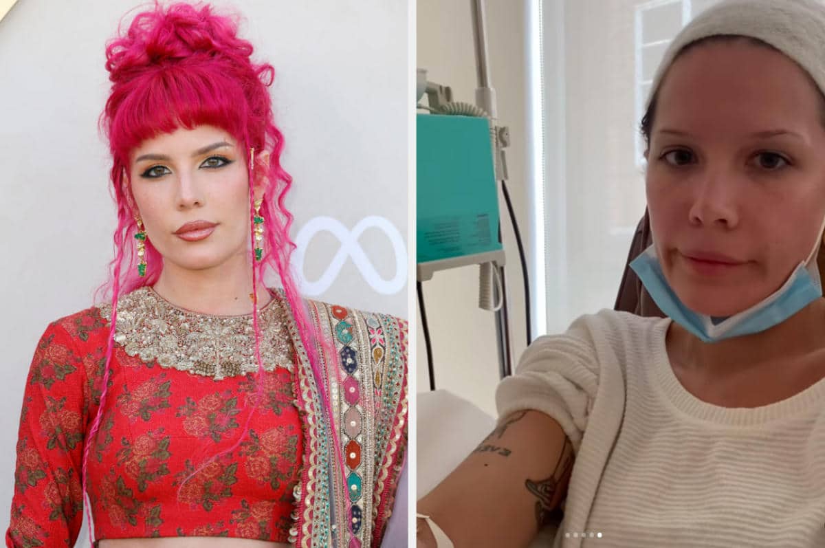 Fans Shower Halsey With Supportive Messages After The Singer Shared An ...